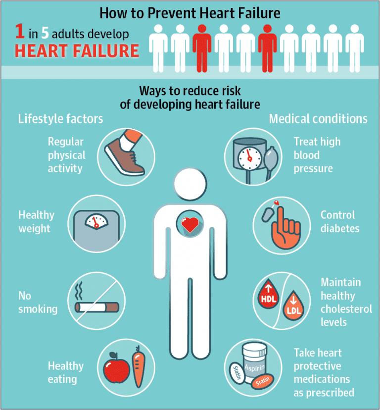 WHAT IS HEART FAILURE? - BIMS Hospital